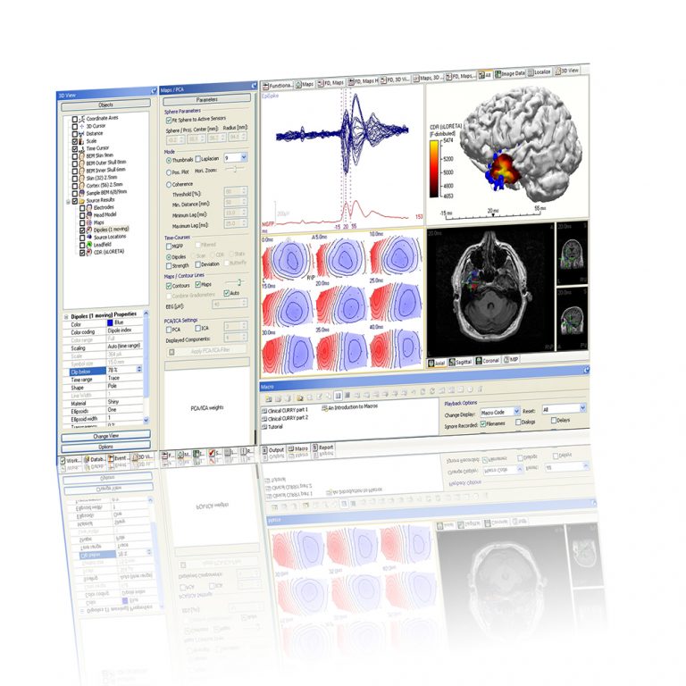 neuroscan | scan-med.com
