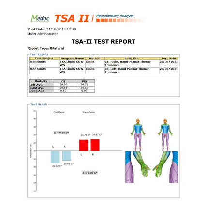 TSA-II NeuroSensory Analyzer | scan-med.com